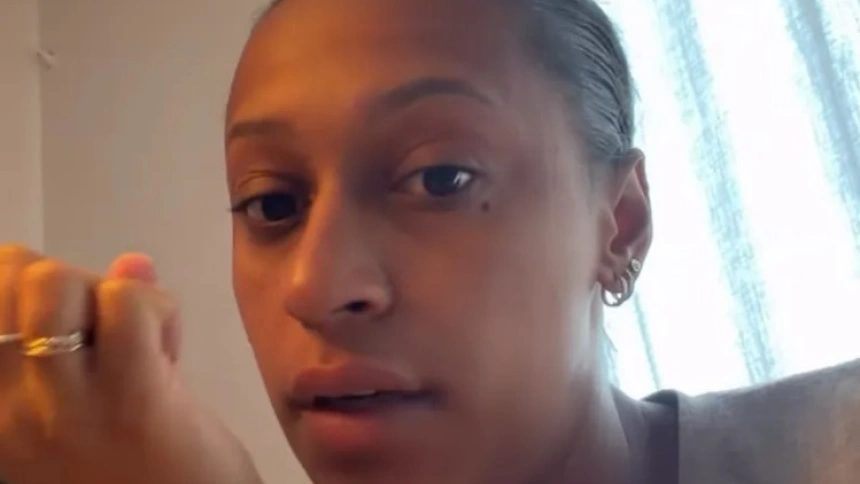 Los problemas de alopecia de Ana Peleteiro en el embarazo que relaciona ...